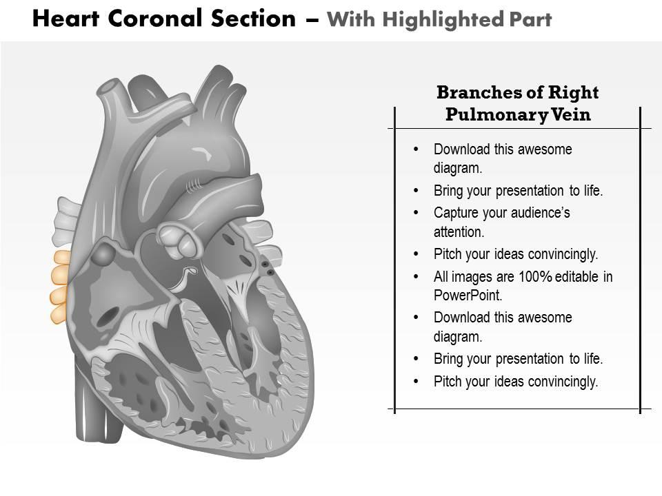 0514 Heart Coronal Section Medical Images For PowerPoint | PPT Images ...
