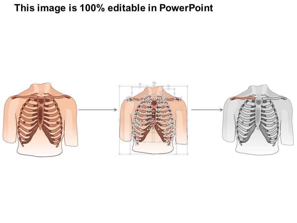 0514 Male Chest Wall Anterior View Medical Images For Reverse