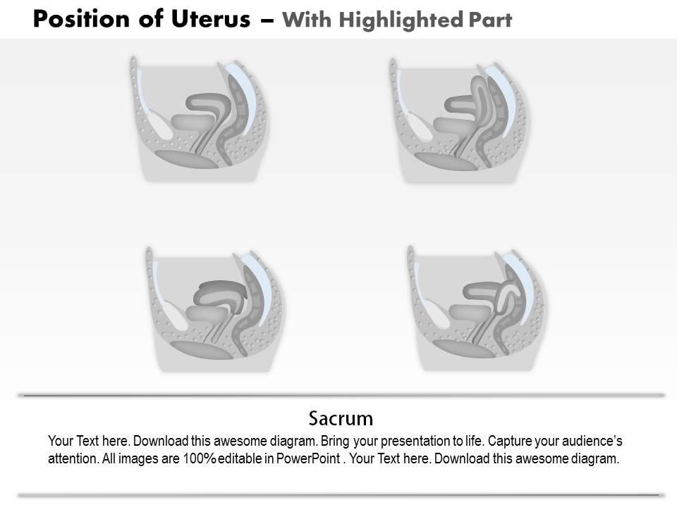 0814 Position Of Uterus Medical Images For Powerpoint | Presentation ...