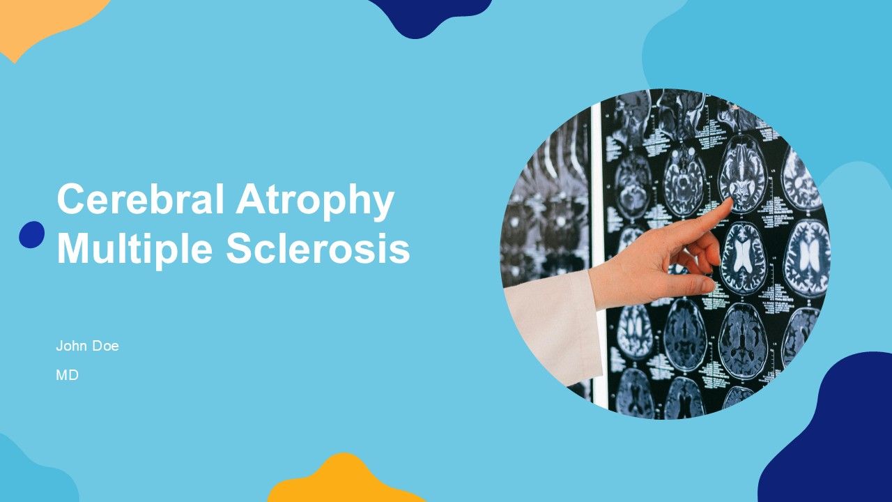 Cerebral Atrophy Multiple Sclerosis PPT Template ST AI