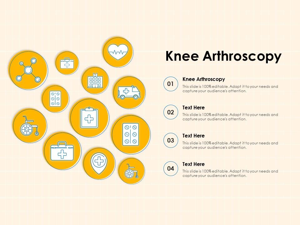 Knee Arthroscopy Ppt Powerpoint Presentation Professional Summary