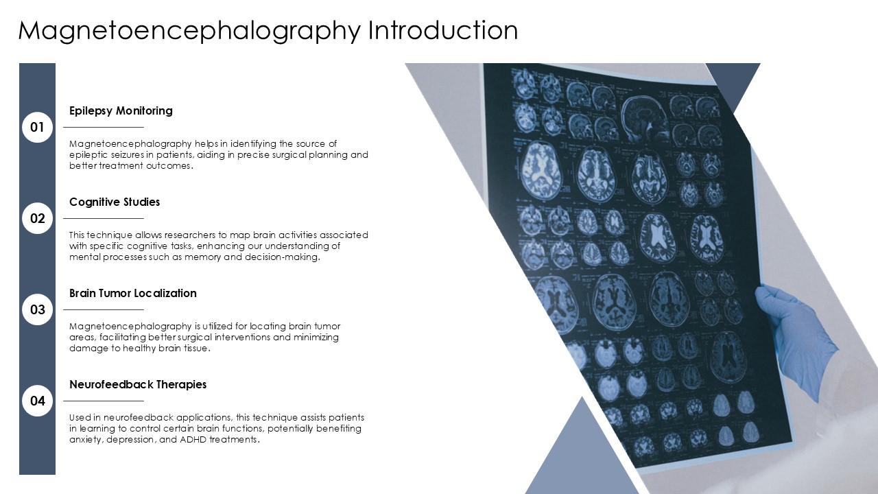 Magnetoencephalography Introduction PPT Presentation ST AI SS PPT Slide