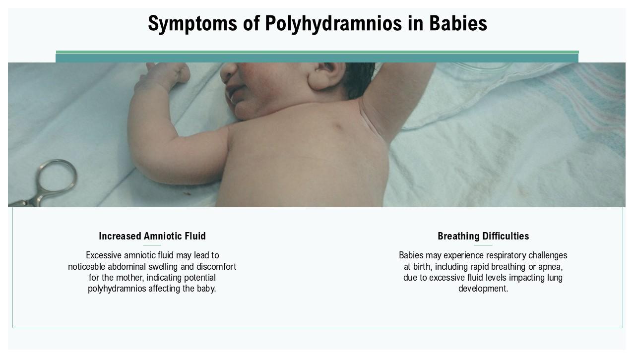 Polyhydramnios Symptoms Baby PPT Graphics ACP PPT Template