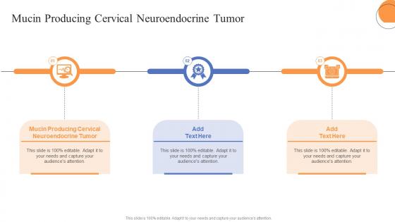 Mucin Producing Tumor PowerPoint Presentation and Slides | SlideTeam