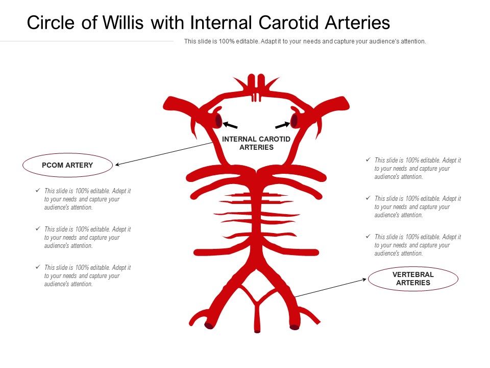 Circle Of Willis Carotid Artery